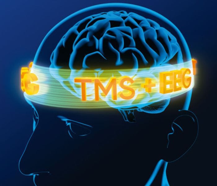 TMS research Researchers - MagVenture